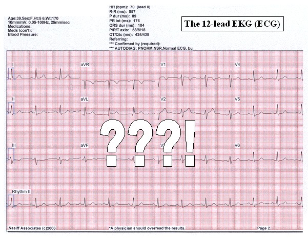 ECG and Intro to 12 lead – Lifeline Training Center